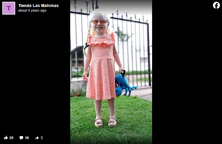 The Albino Twins Who Captivated the World — See Them Now - Daily News
